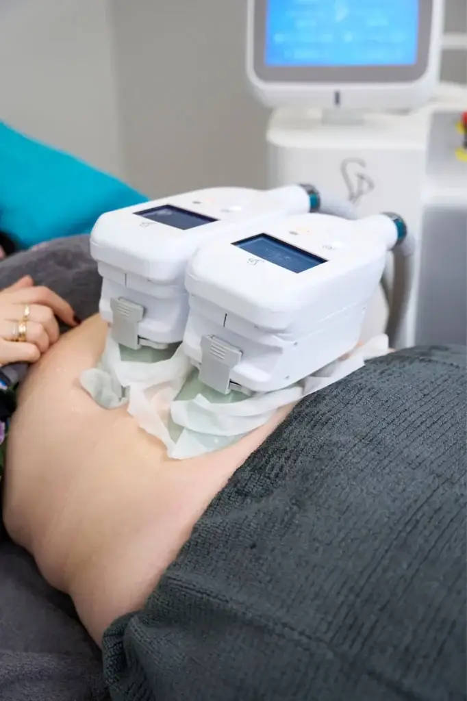 What is Fat Freezing? - Heatherlea Clinic